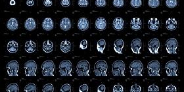 Call for schools to beware ‘neuro-myths’ | Tes Magazine Call for schools to beware ‘neuro-myths’ | Tes Magazine